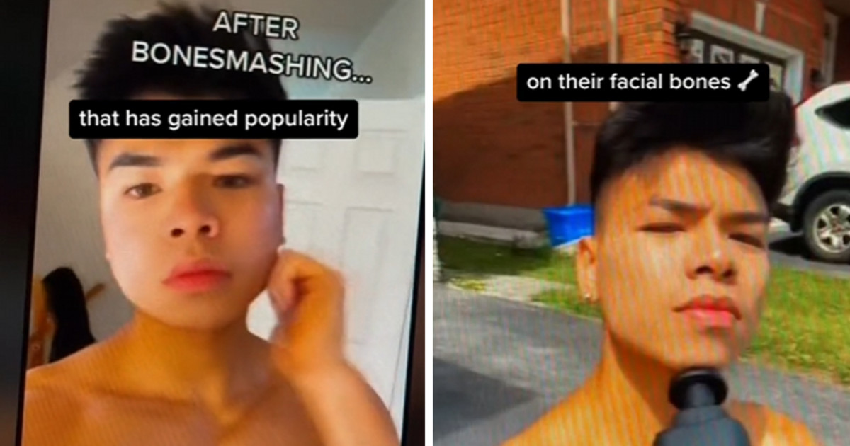 «Μην σπάτε σκόπιμα τα οστά στο πρόσωπό σας» – Πώς το «bone smashing ...