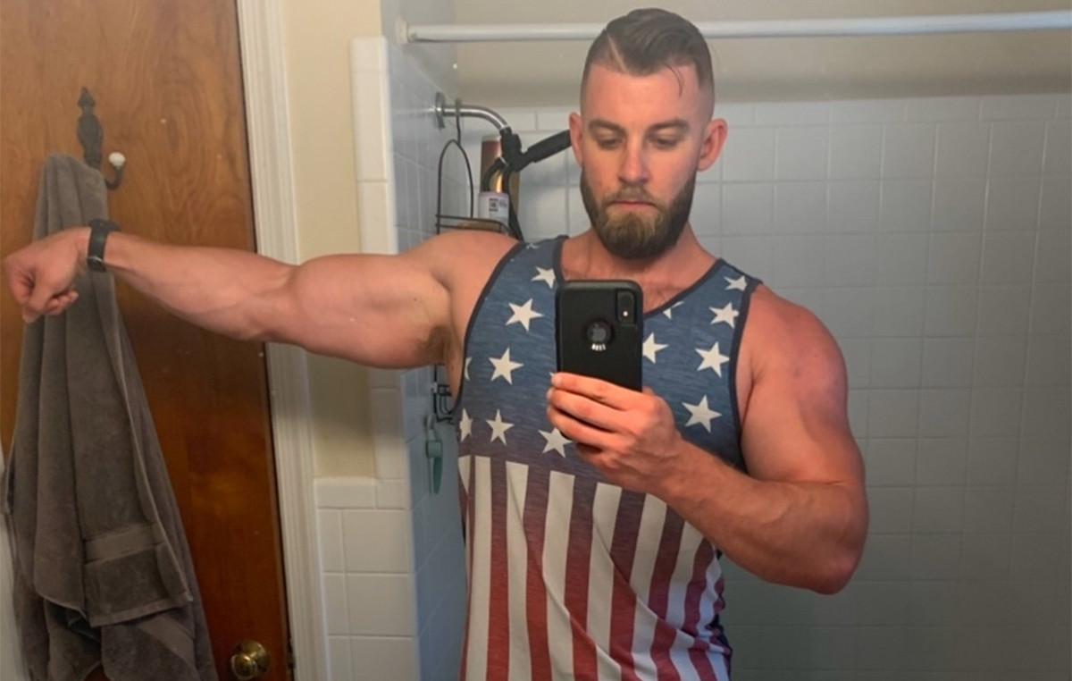 He took anti -hair loss drugs - now claims that he was raging his ...