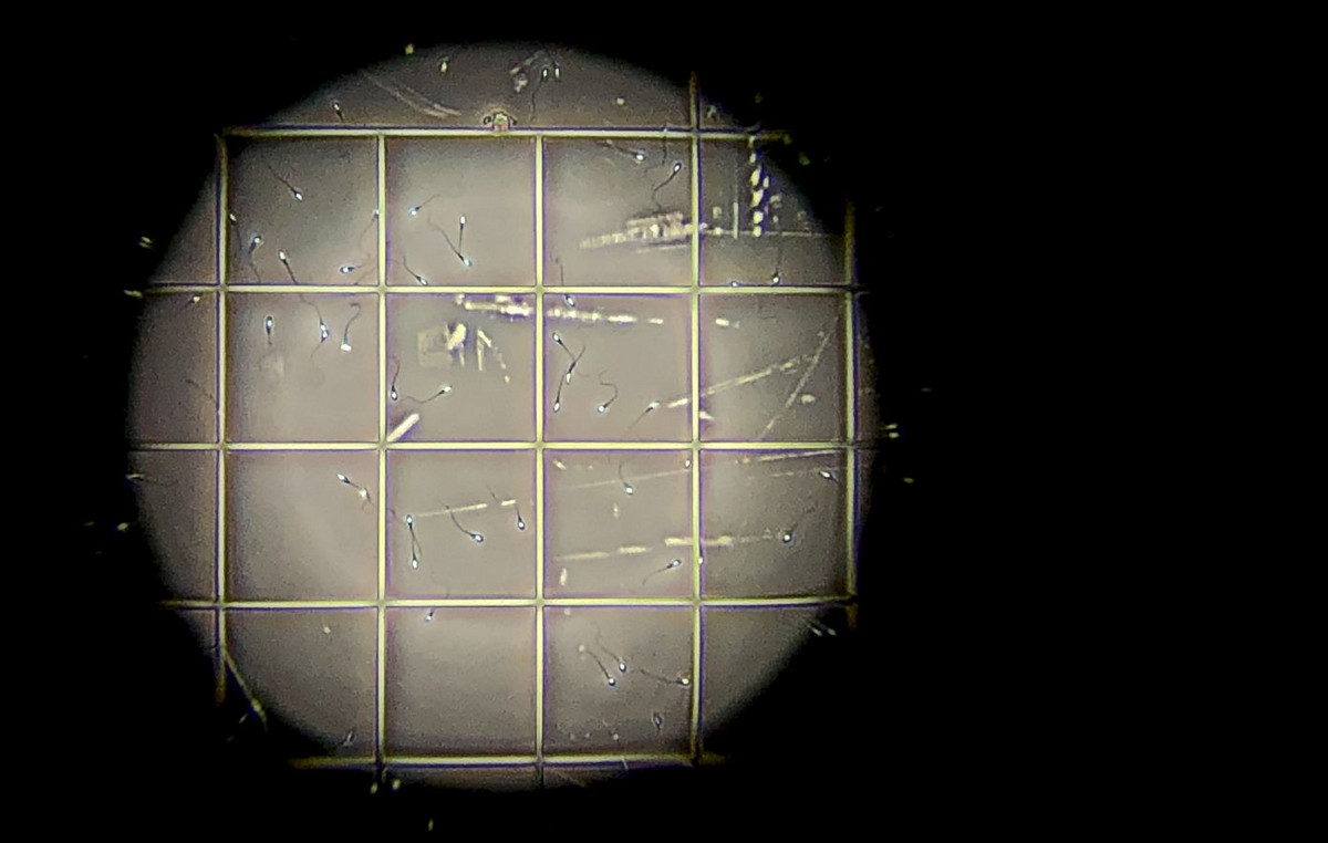 How Danish sperm donor Kgeld's serious genetic abnormality was revealed ...